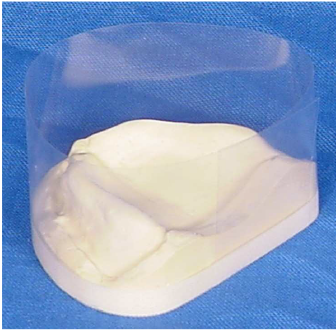 Easy dental model duplication technique using silicone – Garreco ...