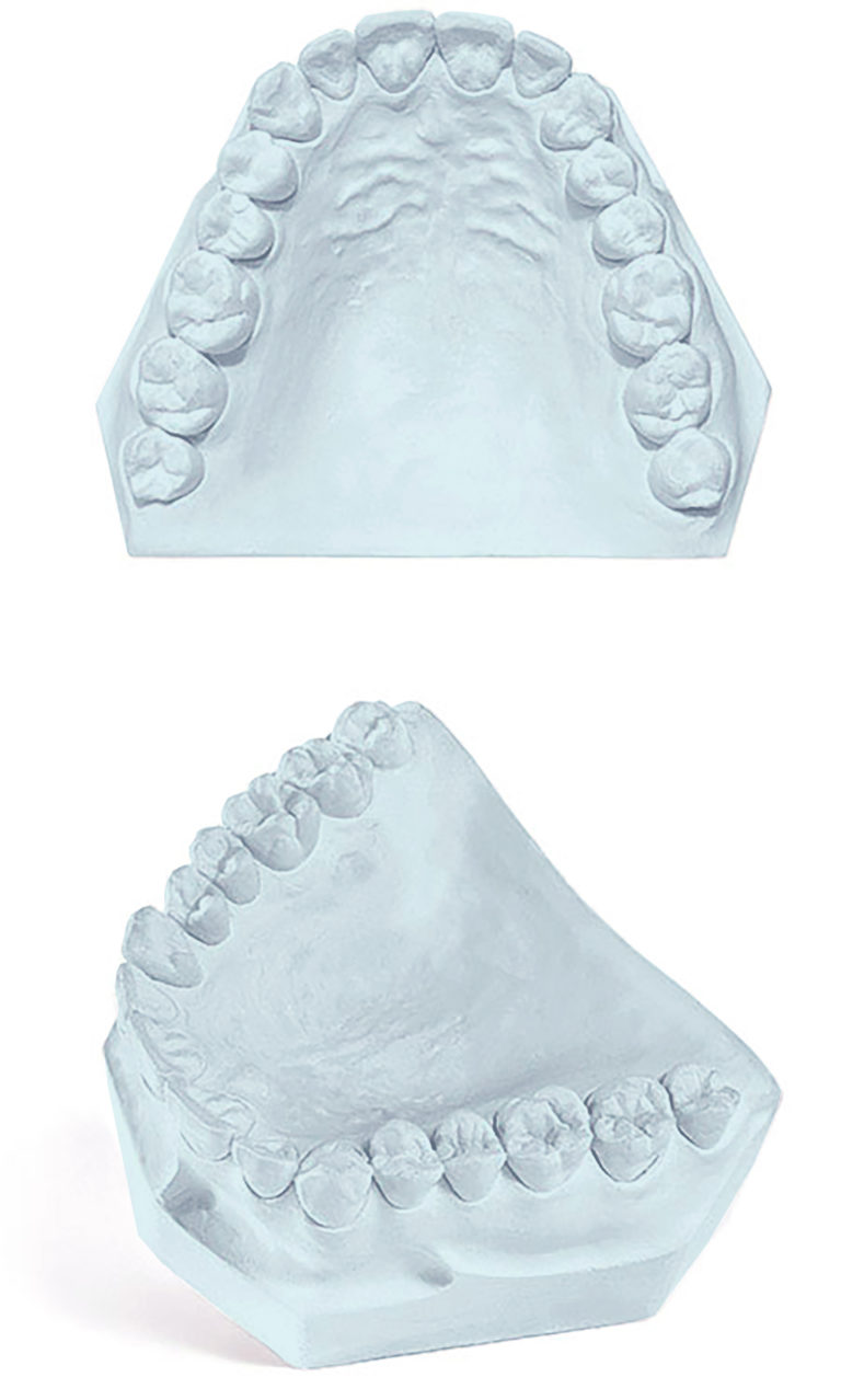 TECSTONE – Garreco™ Dental Lab Products